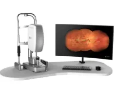 Eye, Fundus Camera, Wide Field Fundus Camera