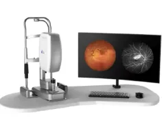 Eye, Fundus Camera, Wide Field Fundus Camera