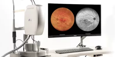 Microclear Apollo: Ophthalmology Medical Equipment, Manufacturer